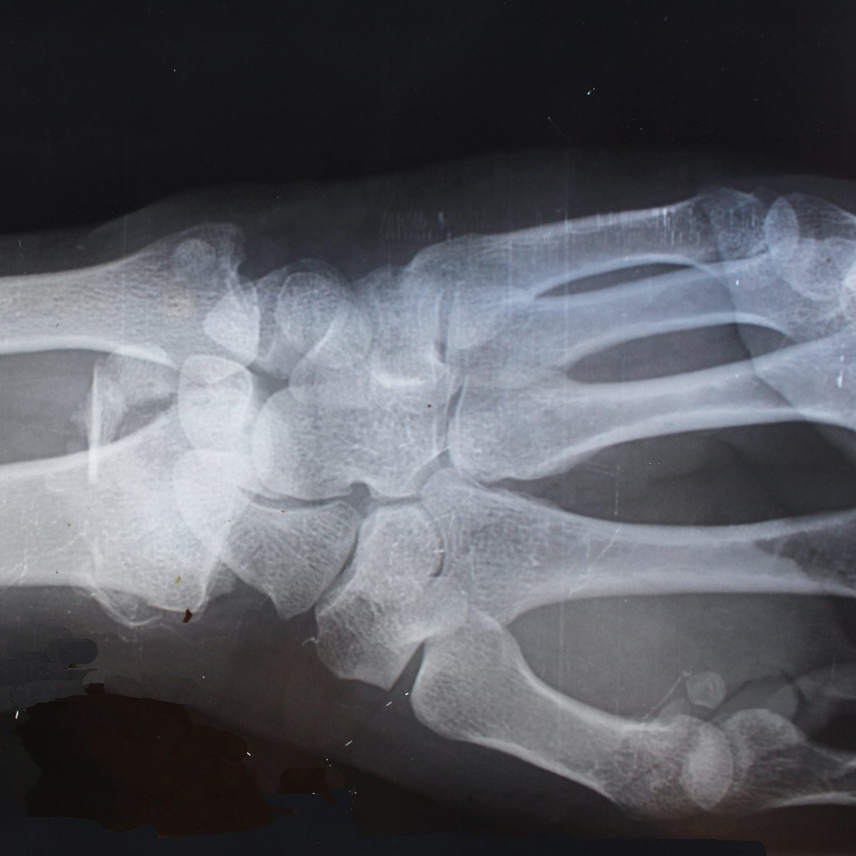 Static & Digital Motion X-Ray • Complete Care